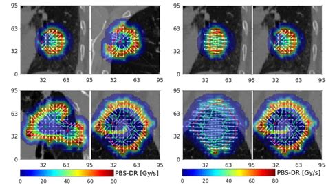 Optimized Pencil Beam Delivery Patterns Enhance Flash Proton Therapy Physics World