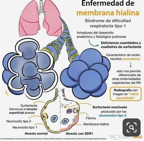 The Diagram Shows The Different Types Of Lungs