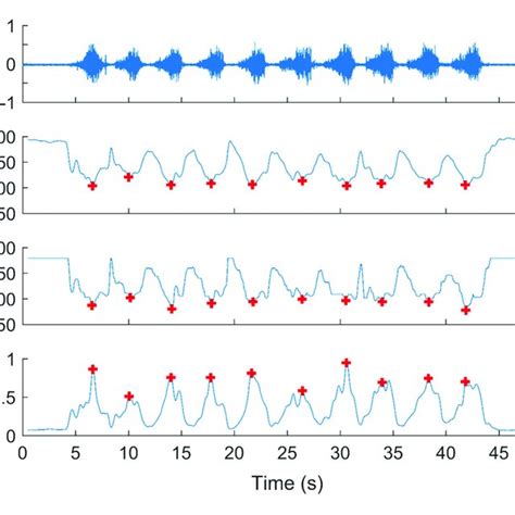 An Example Of Spectral Analysis Of Surface Electromyographic Signals