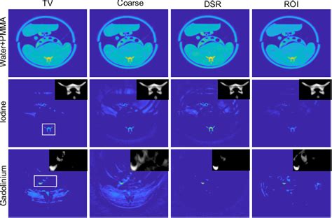 The Results Of Material Decomposition Based On In Vivo Data Left To Download Scientific
