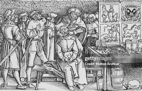 A Medieval Dentist At Work On A Patient Circa 1500 News Photo Getty