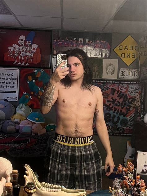 1 Year Post Op Rtopsurgery