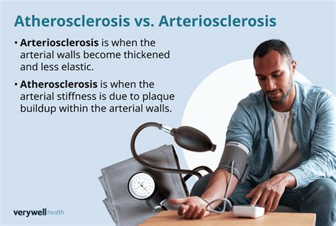 How Atherosclerosis Vs Arteriosclerosis Affect Artery