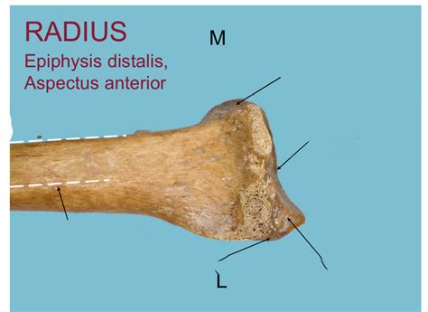 Präpsaal 1 RADIUS Epiphysis distalis Aspectus anterior Diagram Quizlet