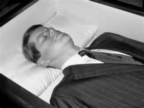 Jfk Autopsy Pictures From The Assassination