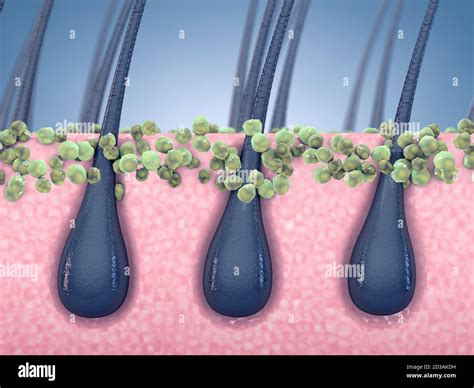 Dandruff Prevention And Antifungal Treatment Human Scalp Hair Roots