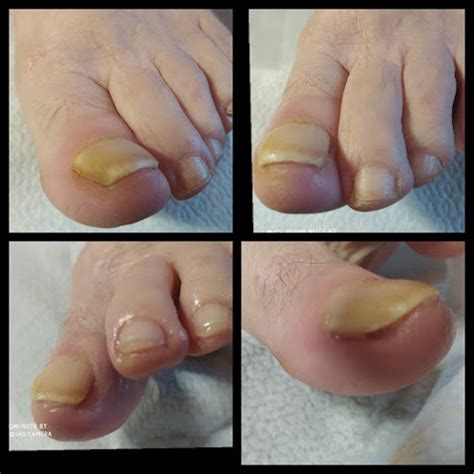 1 αξιολόγηση για Ποδολογικο κεντρο Γιατρός στην Χαλκίδα Στερεά Ελλάδα