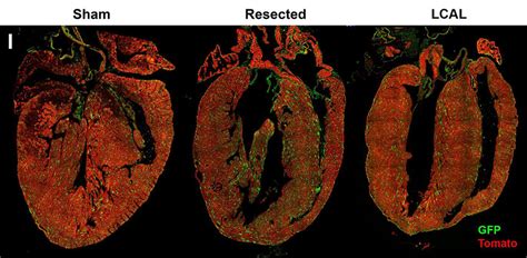 杨中州与刘耕课题组发表心肌损伤后再生与修复研究成果