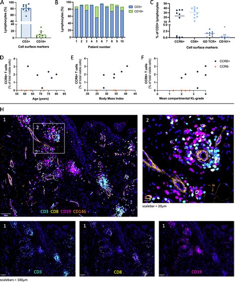 Lymphocytes In Advanced Oa Synovium A B Relative Frequency Of T Download Scientific