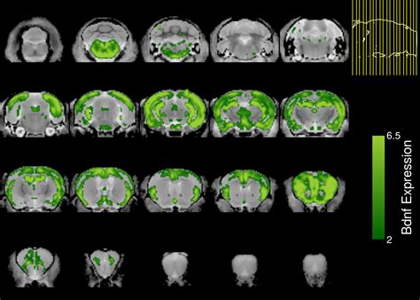 Preferential Spatial Gene Expression In Neuroanatomy The Mouse