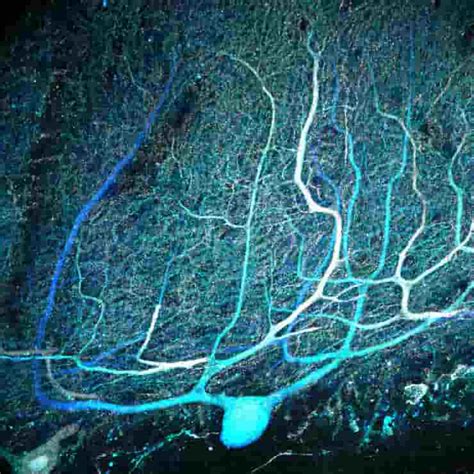 Human Cerebellum Purkinje Cells Have Multiple Climbing Fiber Inputs