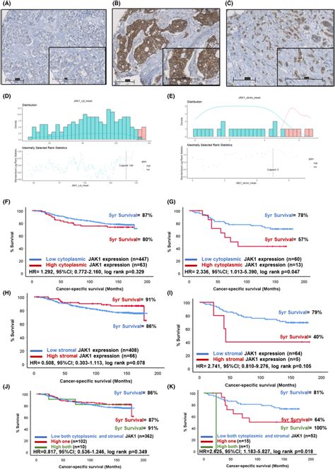 Expression Of Jak In Breast Cancer Representative Images Showing