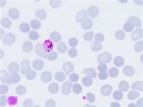 Malaria Detection Object Detection Dataset And Pre Trained Model By