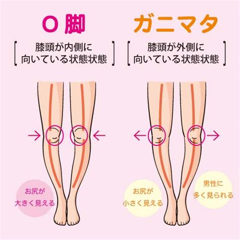 O脚の原因と治し方まとめ！美脚を手に入れるためのストレッチとは・・・？ 100テク 2ページ目
