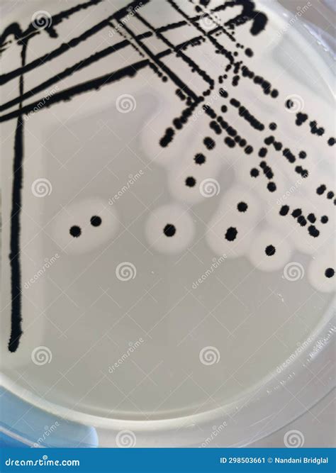 Staphylococcus Aureus On Baird Parker Agar Stock Image 298503661