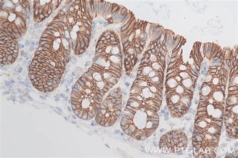 E Cadherin Antibody 84646 3 Rr Proteintech