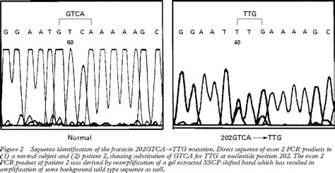 Figure 2 From Identification Of Three Novel Frameshift Mutations In Patients With Friedreich S