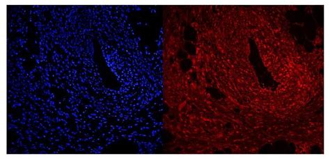 Anti Nfic Ctf Antibody Picoband™ Bosterbio