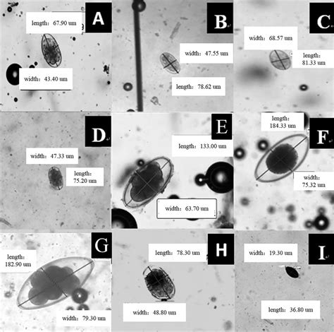 Identification Of Gins In Sheep A Trichostrongylus Spp B