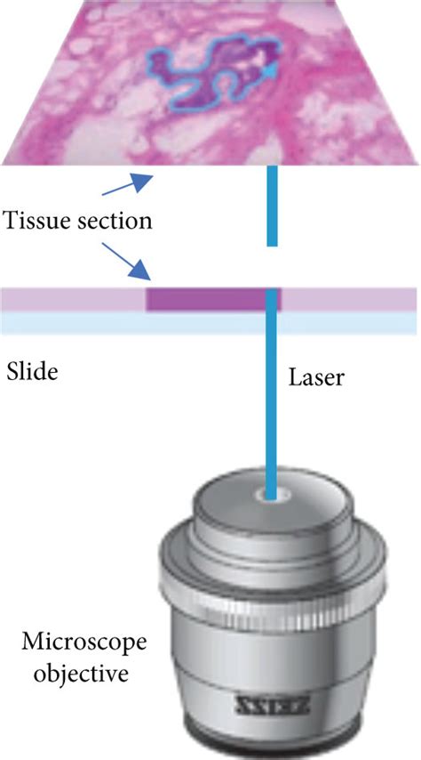 Inverted Microscope Used In Laser Microbeam Lmm And Laser Capture Download Scientific Diagram