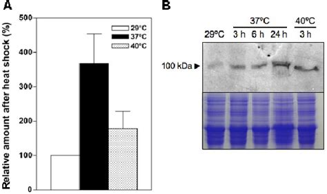 Analysis Of Trypanosoma Cruzi Hsp104 Gene Expression During Heat Shock
