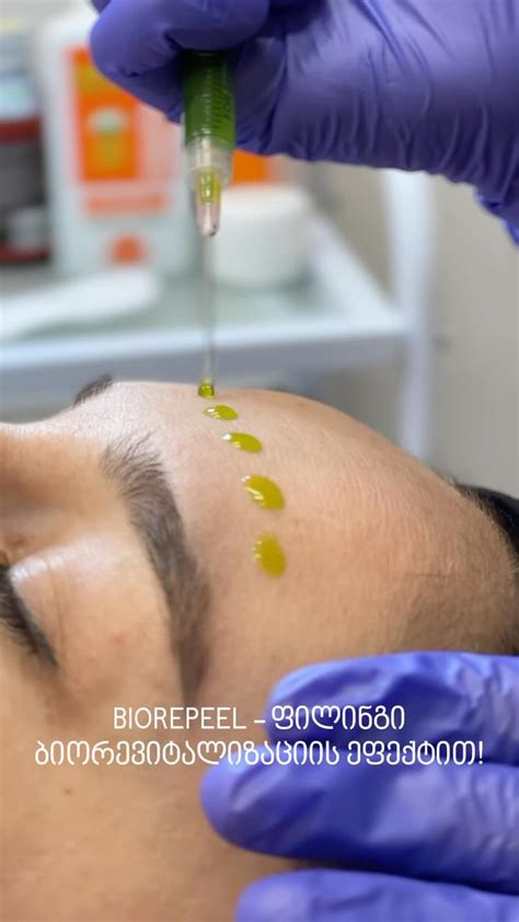 Clinic Xxi Aesthetic And Medicine Tamar Tsitsishvili Cowgill Md 🧬ეგზოსომები თმის ცვენის