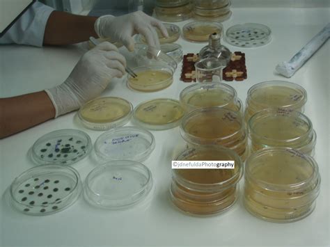 A Glance At Sensitivity Testing Medical Technology Avenue