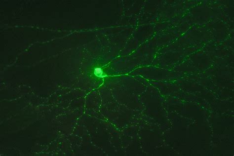 Intrinsically Photosensitive Retinal Ganglion Cells
