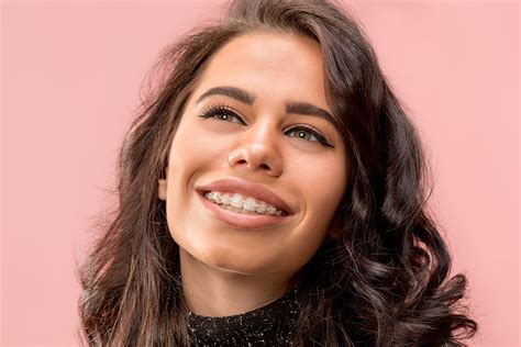 4 Beneficios de la ortodoncia que NO conocías Clínica Dental