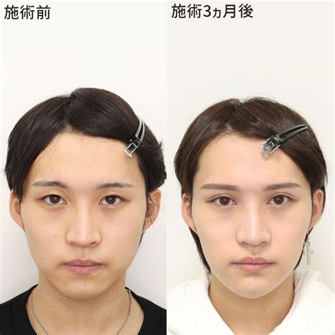 【男性美容】山田院長のトータルビューティー｜症例写真・ビフォーアフター｜美容整形･美容外科のtaクリニックグループ