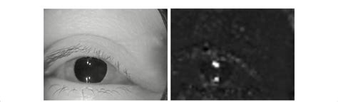 An Example Of Extracted Features A Original Image B Extracted Download Scientific Diagram