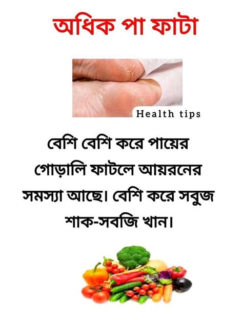 তিতির গ্যালারি তিতির গ্যালারি Added A New Photo