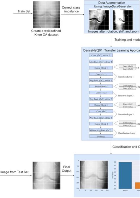 Figure From A Transfer Learning Approach For Classification Of Knee Osteoarthritis Semantic