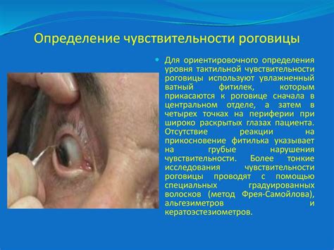 Методы исследования в офтальмологии презентация онлайн