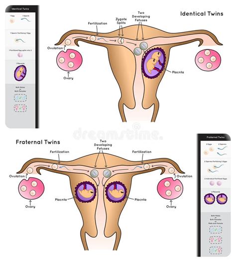 Fraternal Twins Stock Illustrations 60 Fraternal Twins Stock Illustrations Vectors And Clipart