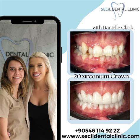 İbrahim Celik Posted On Linkedin