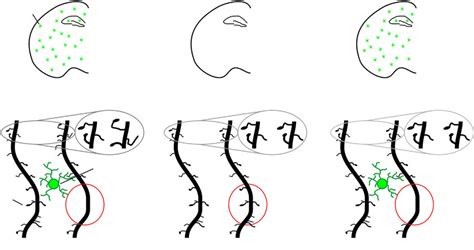 Impact Of Microglia On Synaptic Pruning In The Adult Brain Neuronal