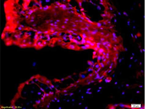 Epcam抗体 Ab216832 Abcam中文官网