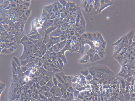 MDA MB 361人乳腺癌细胞 企业官网