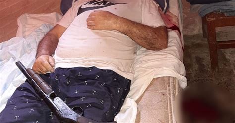 Brutal Intento De Femicidio En La Matanza “tu Papá Me Golpeó Con Una