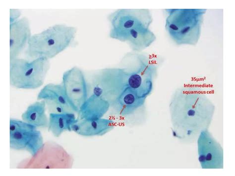 Pap Smear Examination Pptx