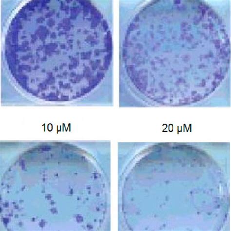 Cell Cycle Phase Distribution Analysis Through Flow Cytometry After