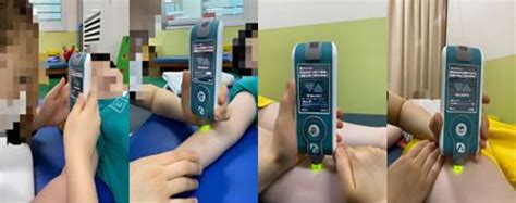 Intra Rater And Inter Rater Reliability Analysis Of Muscle Tone Evaluation Using A Myotonometer