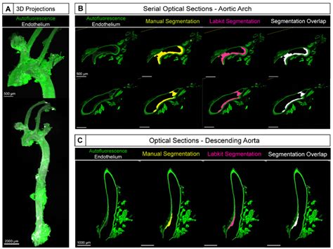 Light Sheet Fluorescent Microscopy Coupled With Labkit Derived Download Scientific Diagram