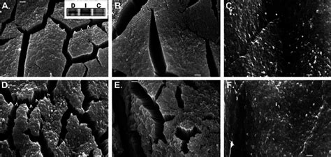 Sem Of Wt A C And Ko D F Enterocyte Surfaces Sampled At Three Download Scientific Diagram