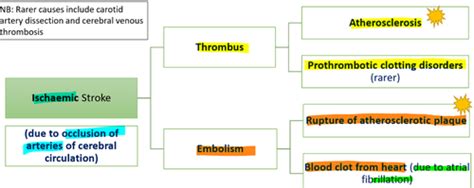 Stroke Flashcards Quizlet