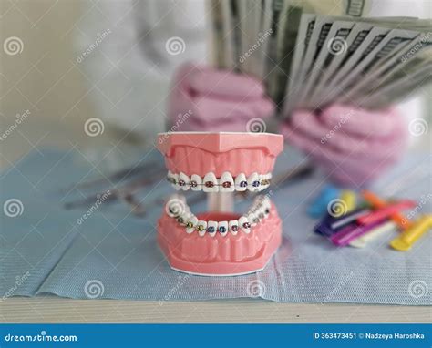 Braces Model Stock Image 2062999