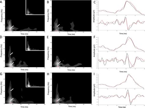 Morlet Wavelet Transform Scalograms With Unfiltered And Filtered Erg