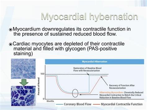 Coronary Classpptx Free Download Coronary Classpptx Free Download