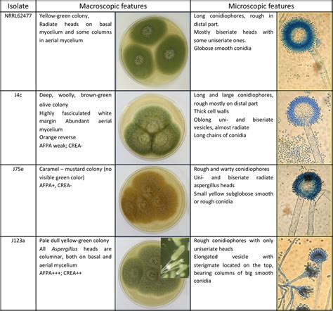 Main Macro And Microscopic Features Of Atypical A Flavus Isolates Download Scientific Diagram